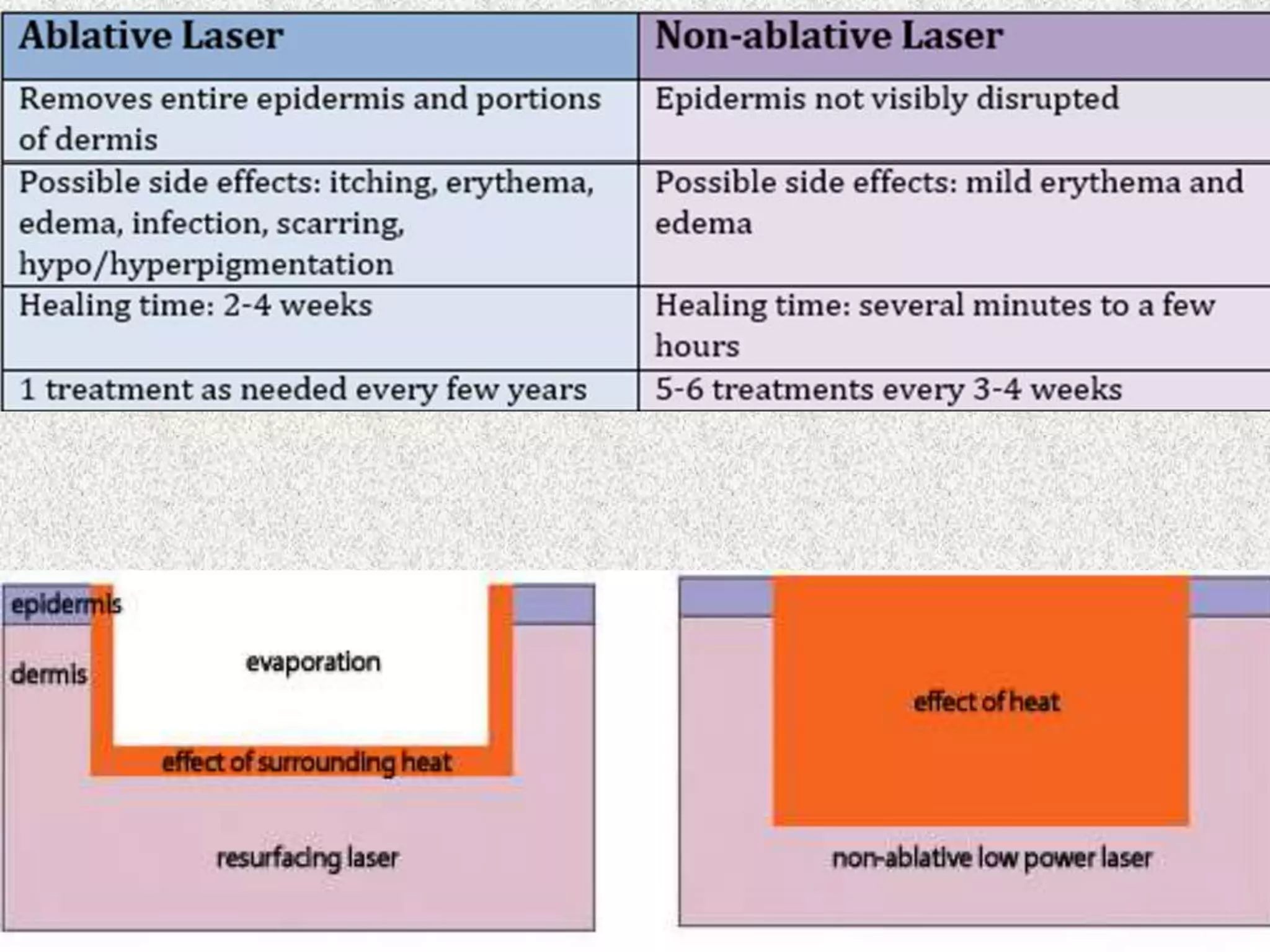 Basics of lasers | PPTX