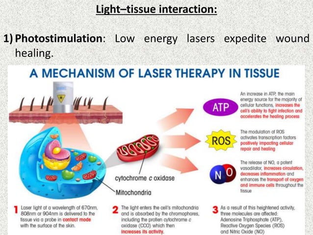 Basics of lasers | PPTX | Skin and Dermatology | Diseases and Conditions