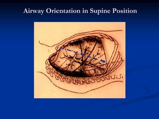 Basics of mechanical ventilation | PPSX