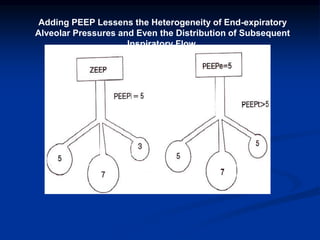 Basics of mechanical ventilation | PPSX