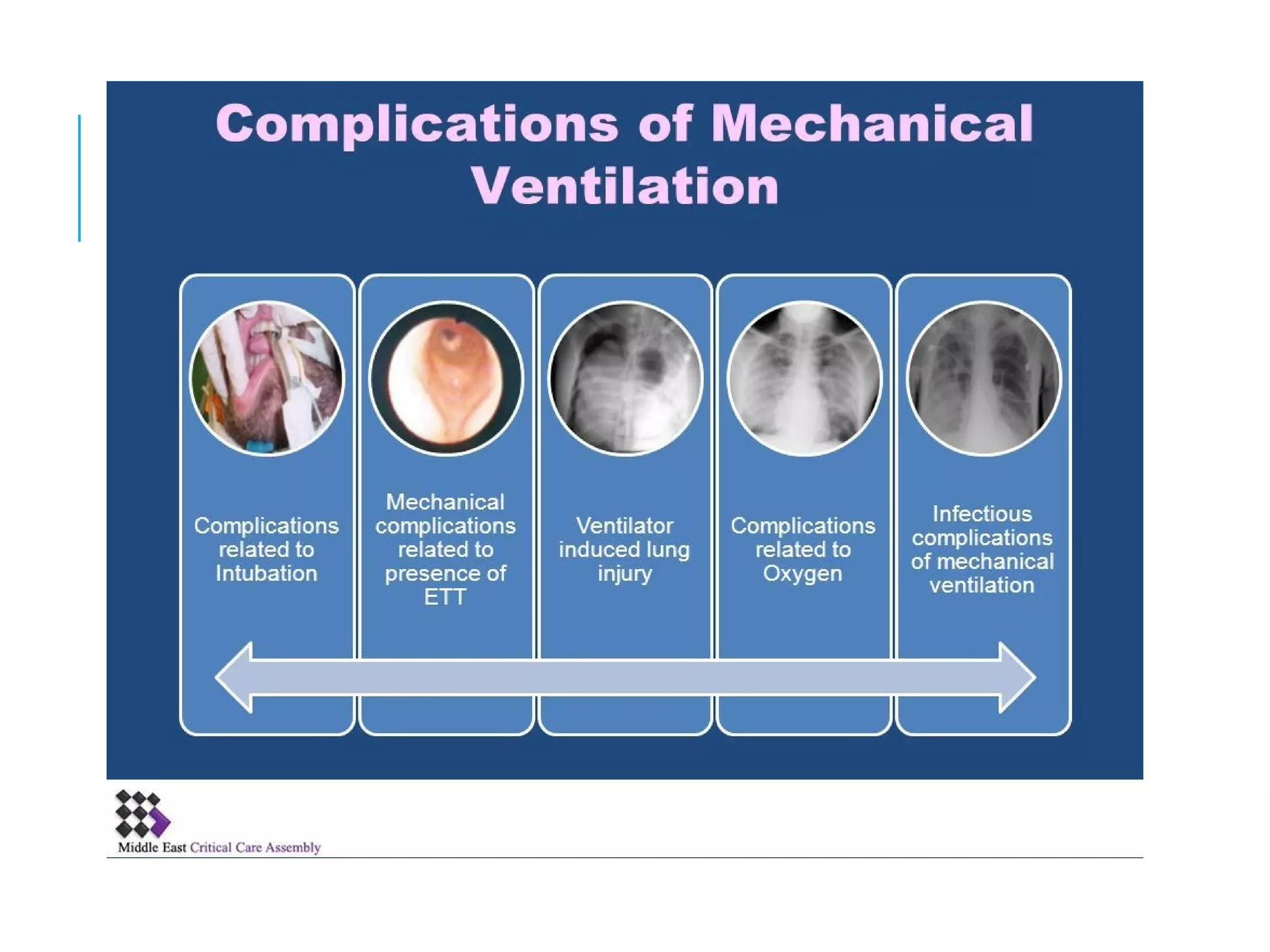 Basics of Mechanical Ventilation | PPT