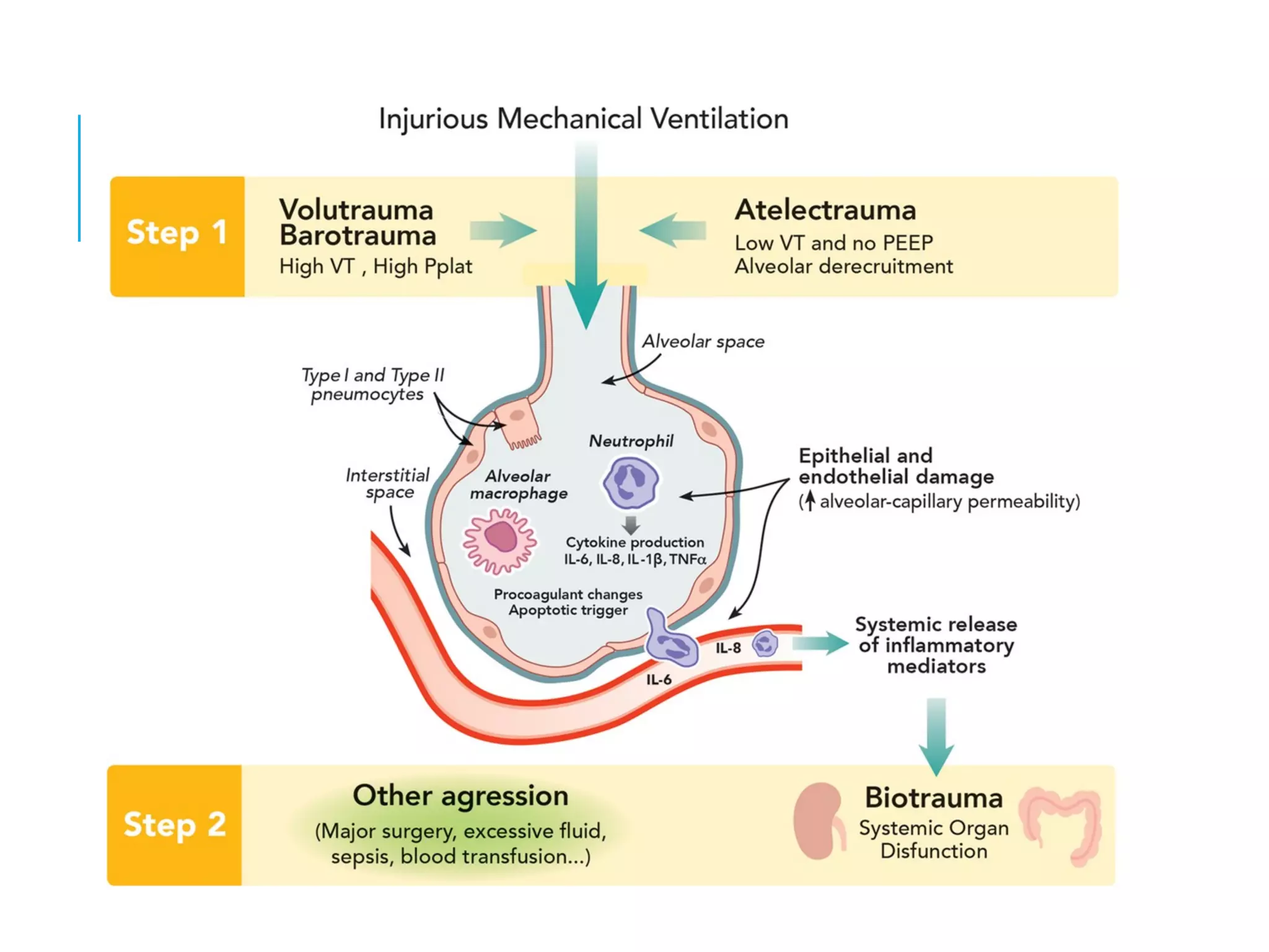 Basics of Mechanical Ventilation | PPT