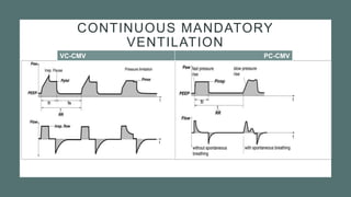 Basics of mechanical ventilation | PPT
