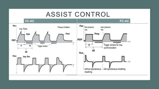 Basics of mechanical ventilation | PPT