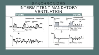 Basics of mechanical ventilation | PPT