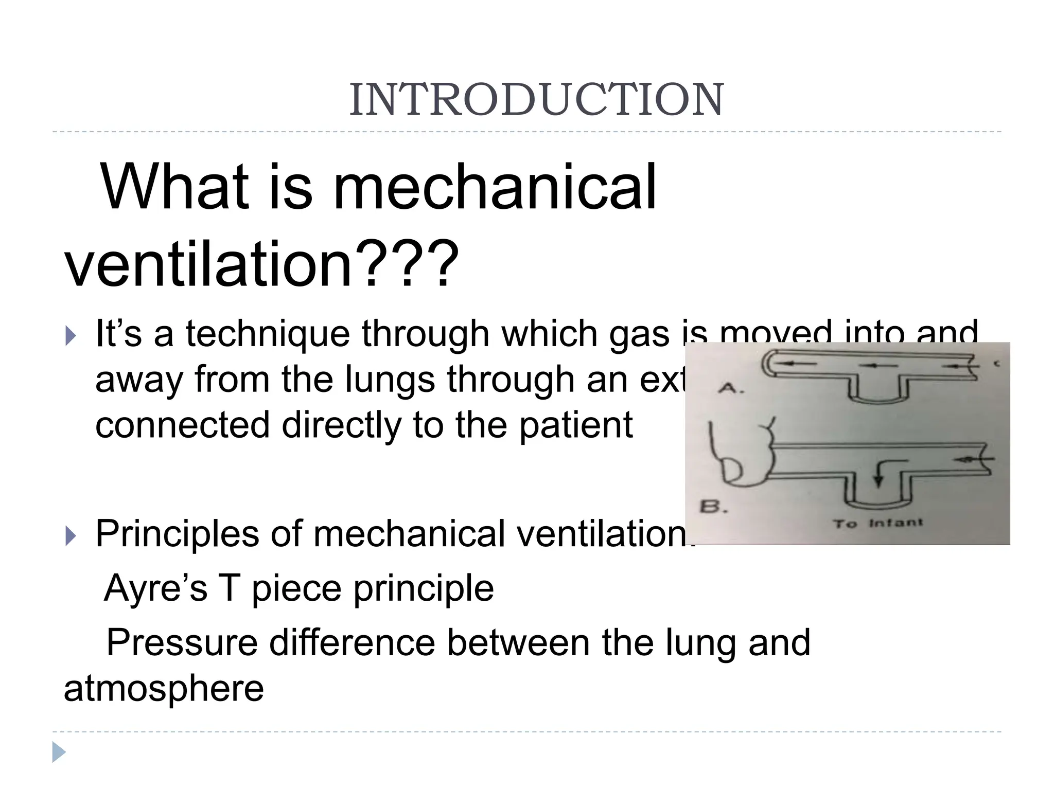 BASICS OF MECHANICAL VENTILATION.pptx in paediatric | PPTX