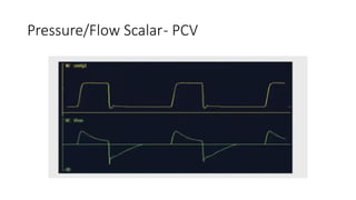 Basics of Mechanical Ventilation by Kaleemullah | PPTX