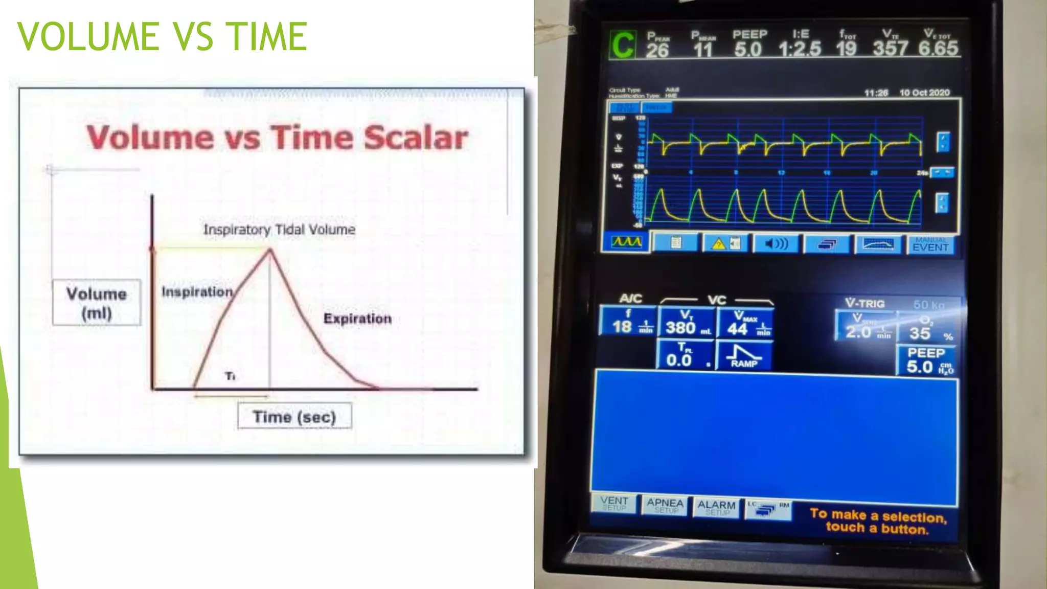 Basics of mechanical ventilation | PPTX