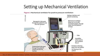 Basics of mechanical ventilator care | PPTX