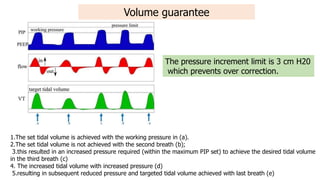basics of mechanical ventilator Dr Asaduzzaman.pptx