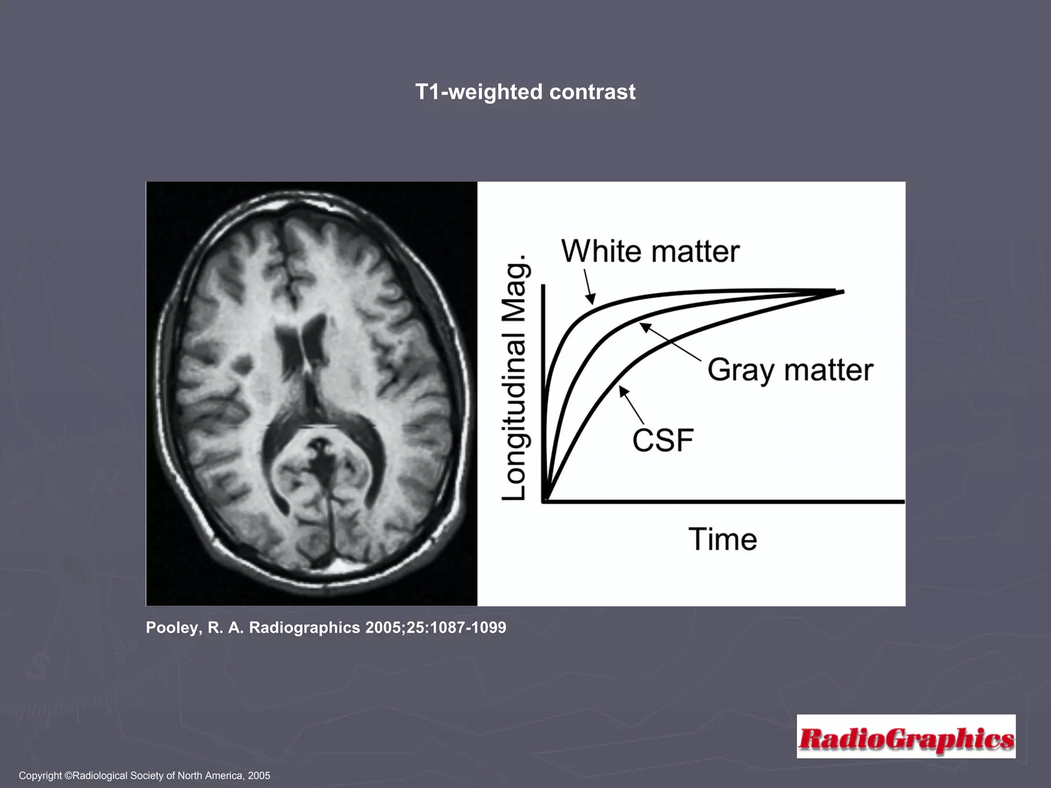 Basics Of MRI | PPT