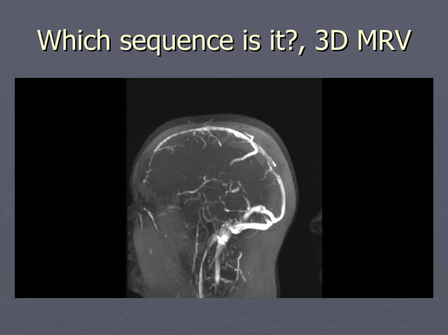 Basics Of MRI | PPT