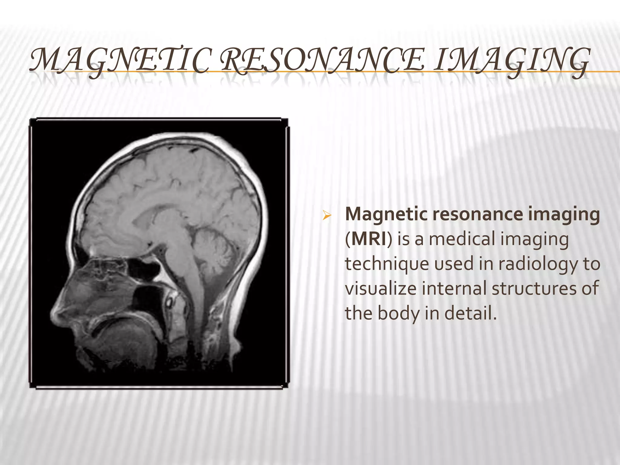 Basics of mri | PPTX