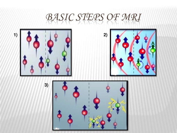 Basics of mri