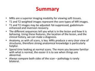 Basics of mri | PPTX