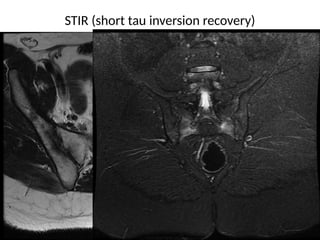 BASICS OF MRI interpretation and imaging.pptx