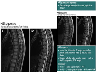 BASICS OF MRI interpretation and imaging.pptx
