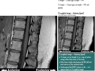 BASICS OF MRI interpretation and imaging.pptx
