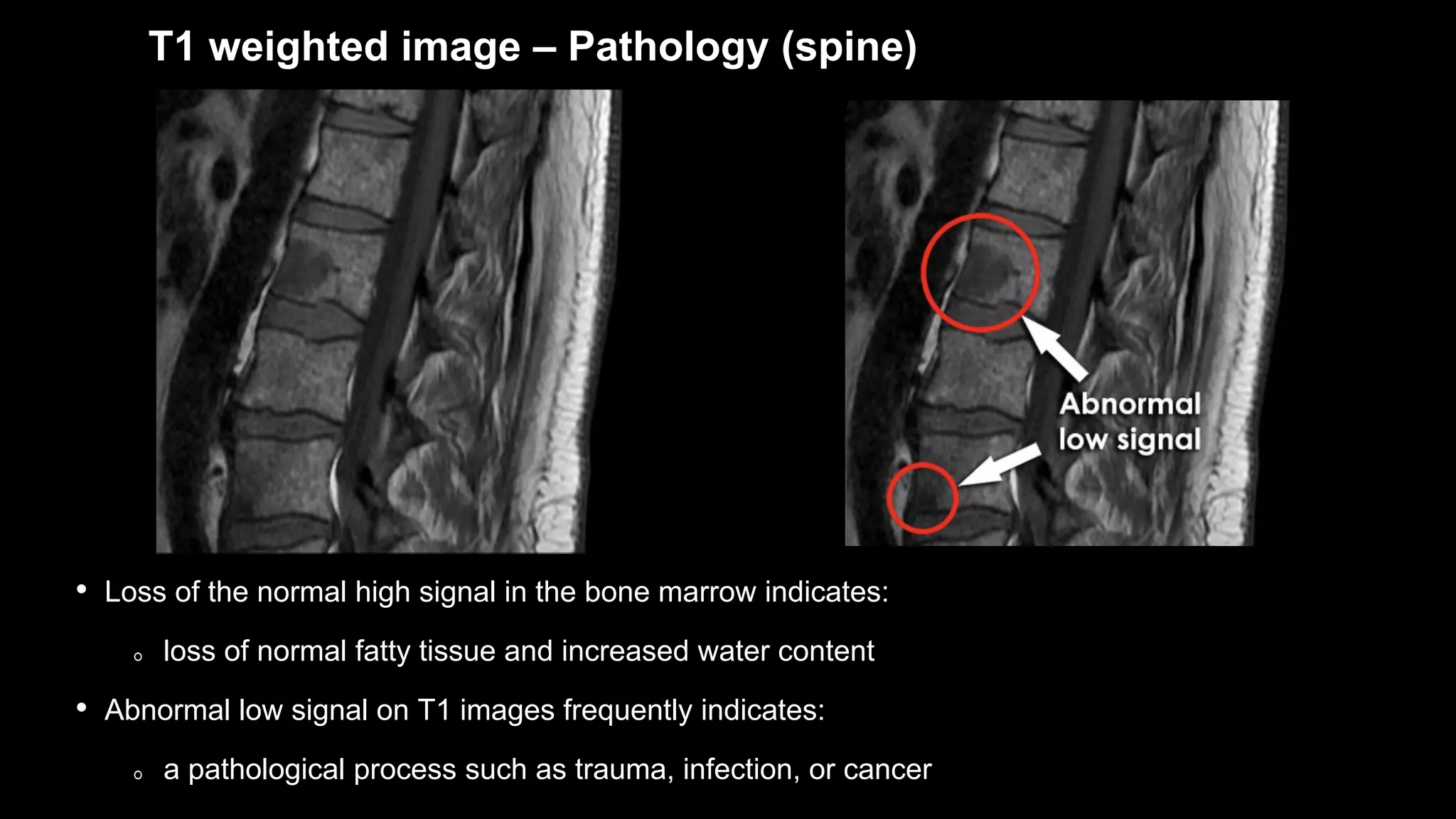 Basics of MRI interpretation; December 2022.pptx