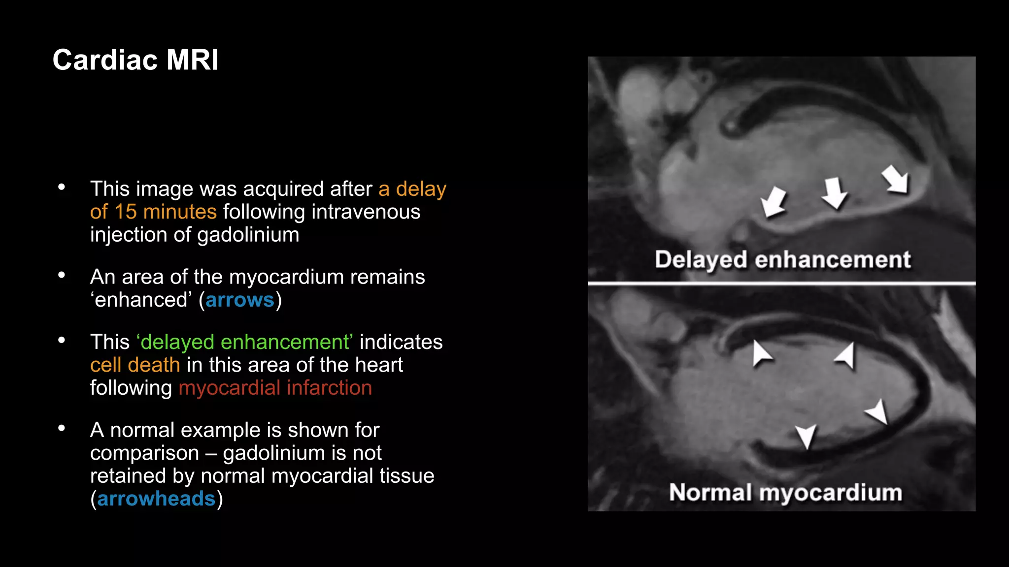 Basics of MRI interpretation; December 2022.pptx