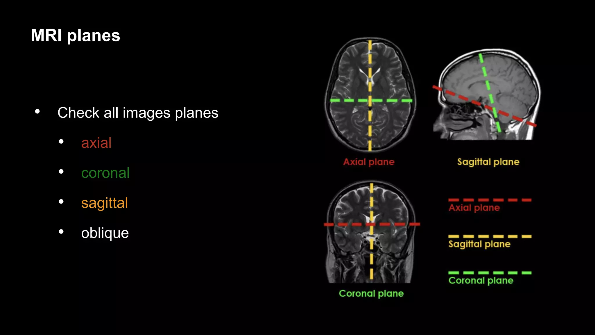 Basics of MRI interpretation; December 2022.pptx