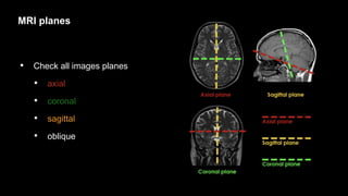Basics of MRI interpretation (December 2022) | PPTX