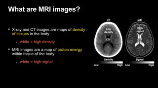 Basics of MRI interpretation (December 2022) | PPTX