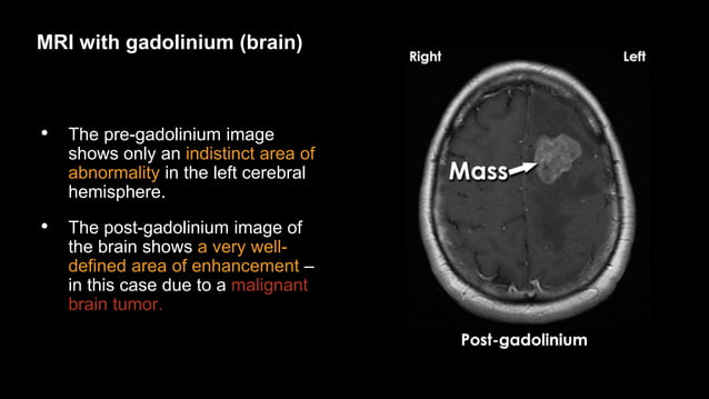 Basics of MRI interpretation; December 2022.pptx