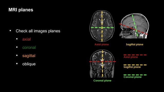 Basics of MRI interpretation; December 2022.pptx