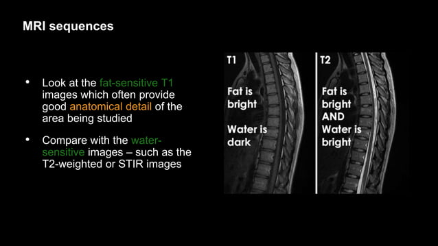 Basics of MRI interpretation; December 2022.pptx