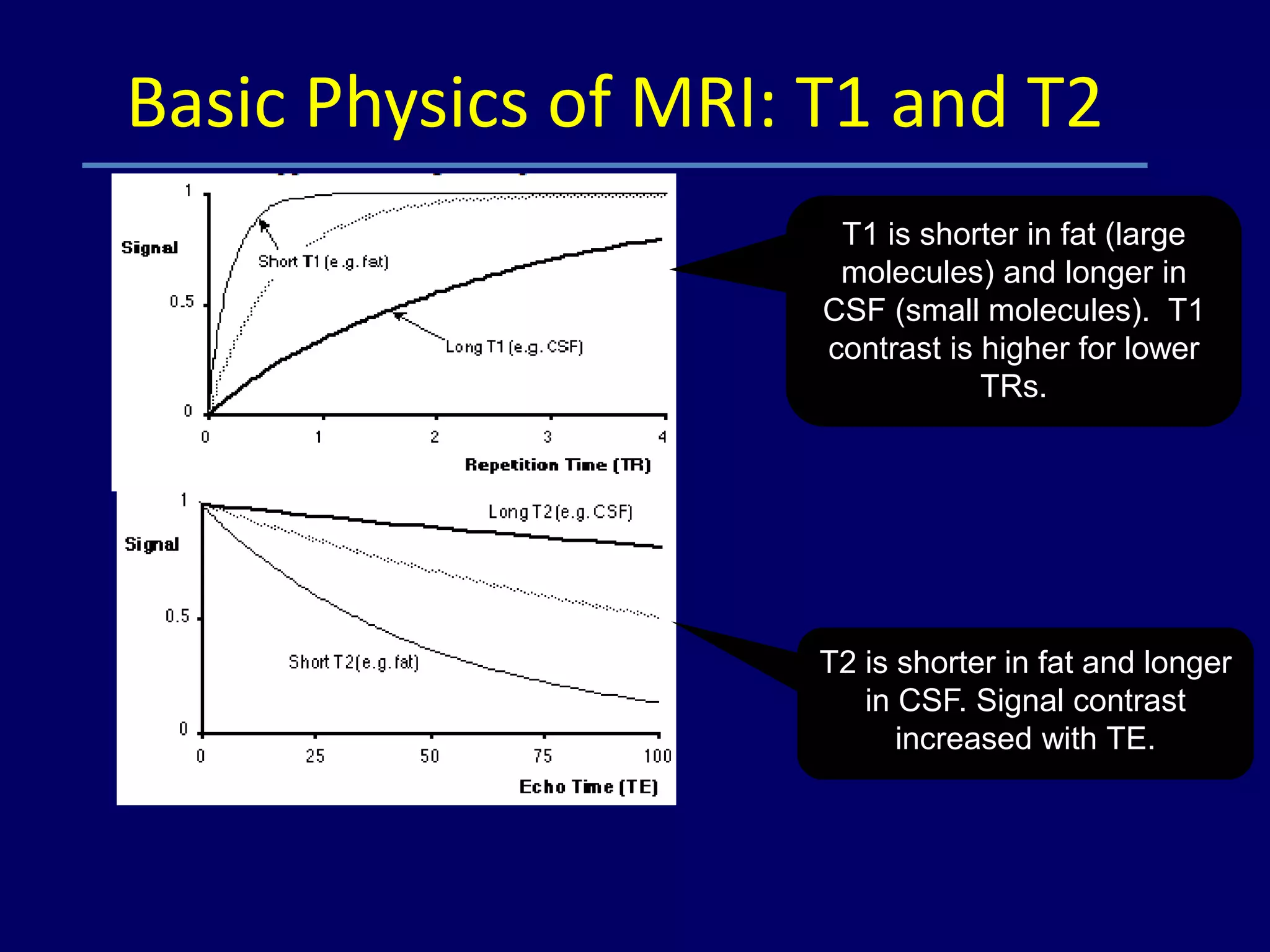 Basics of mri physics Dr. Muhammad Bin Zulfiqar | PPTX