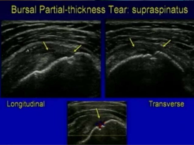 Basics of msk ultrasound By Dr. Raham Bacha