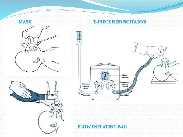 Basics of neonatal resuscitation BY DR.PRITESH PATEL