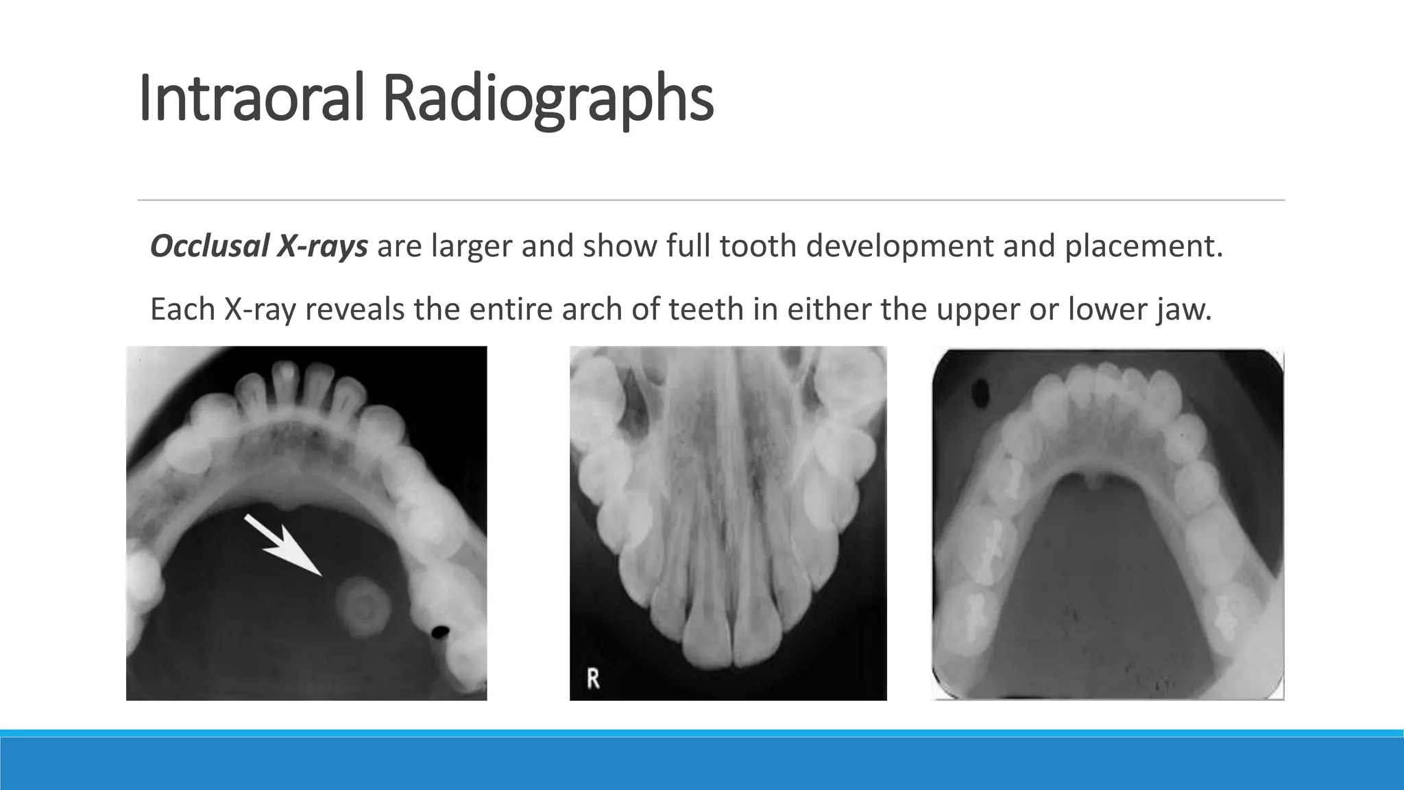 Basics of oral radiology | PPTX