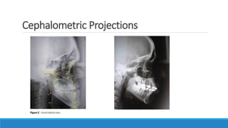 Basics of oral radiology | PPTX