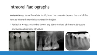 Basics of oral radiology | PPTX