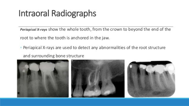 Basics of oral radiology