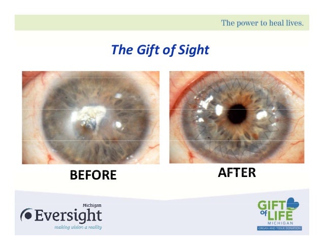 Basics of organ, tissue, eye donation