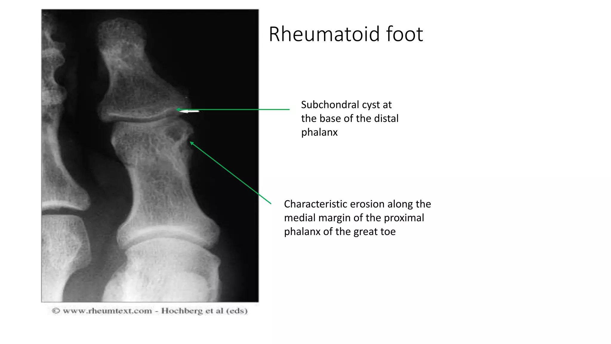 Basics of orthopedic imaging | PDF