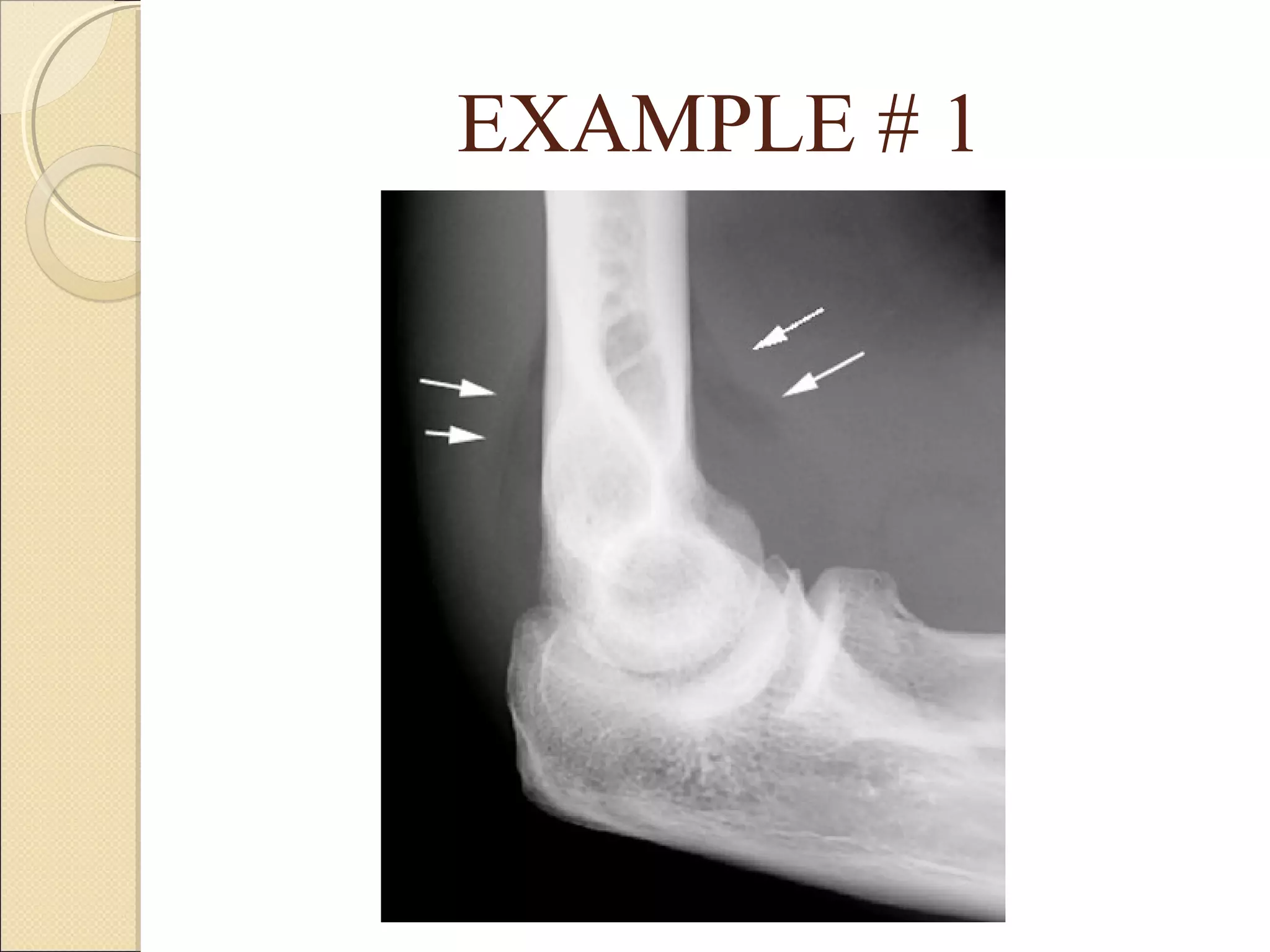 Basics of orthopedic radiology | PPT