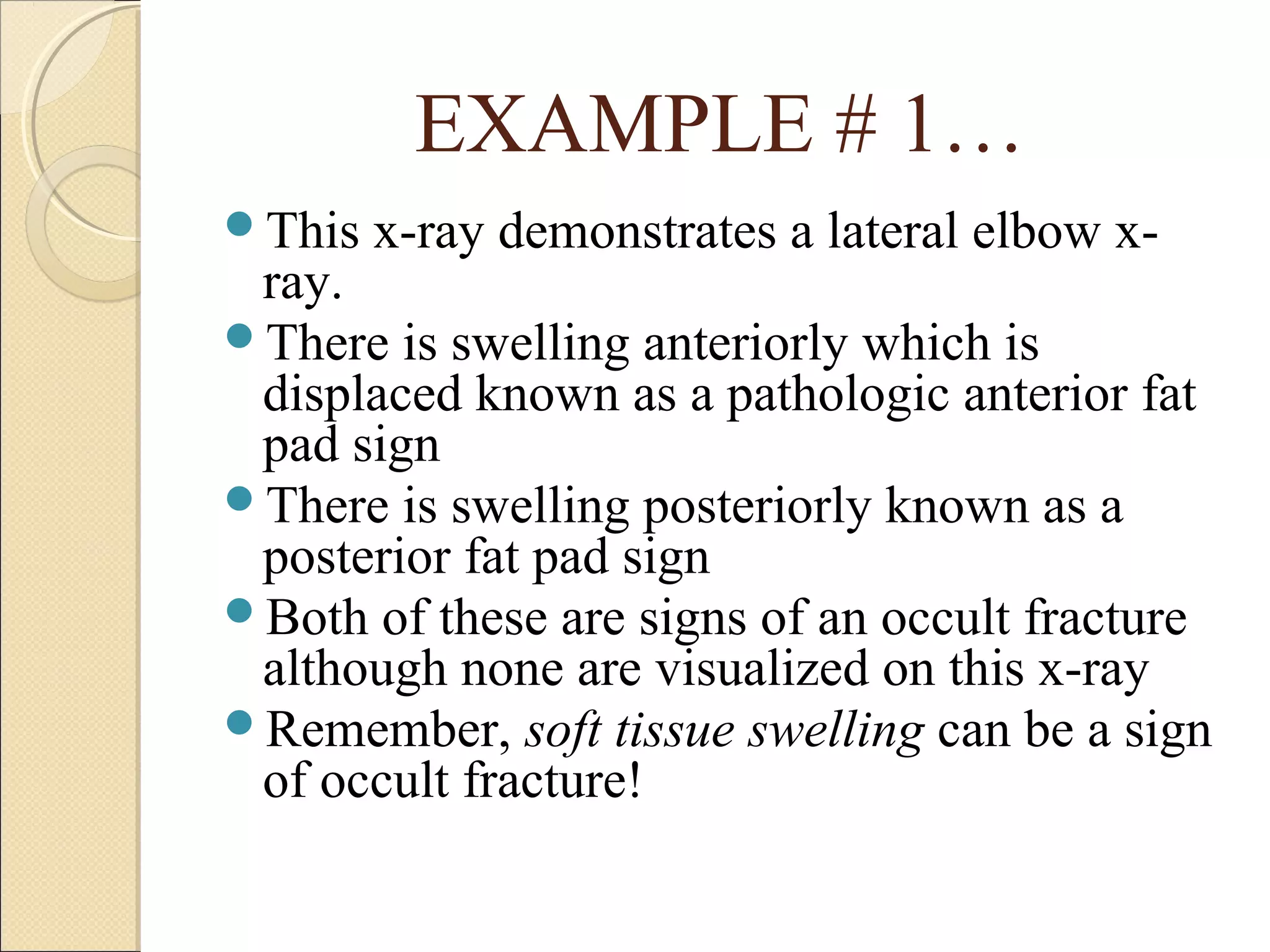 Basics of orthopedic radiology | PPT