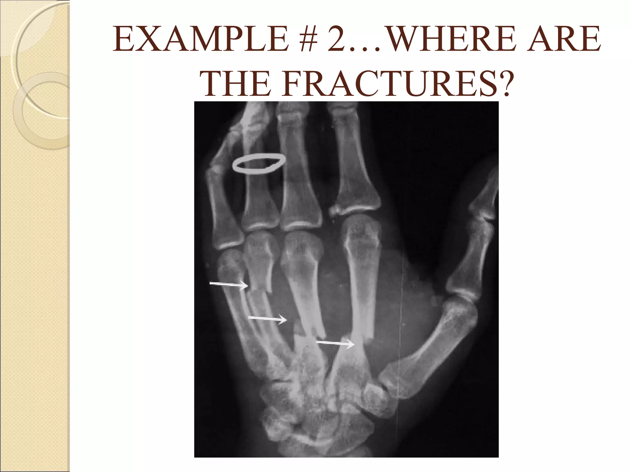 Basics of orthopedic radiology | PPT
