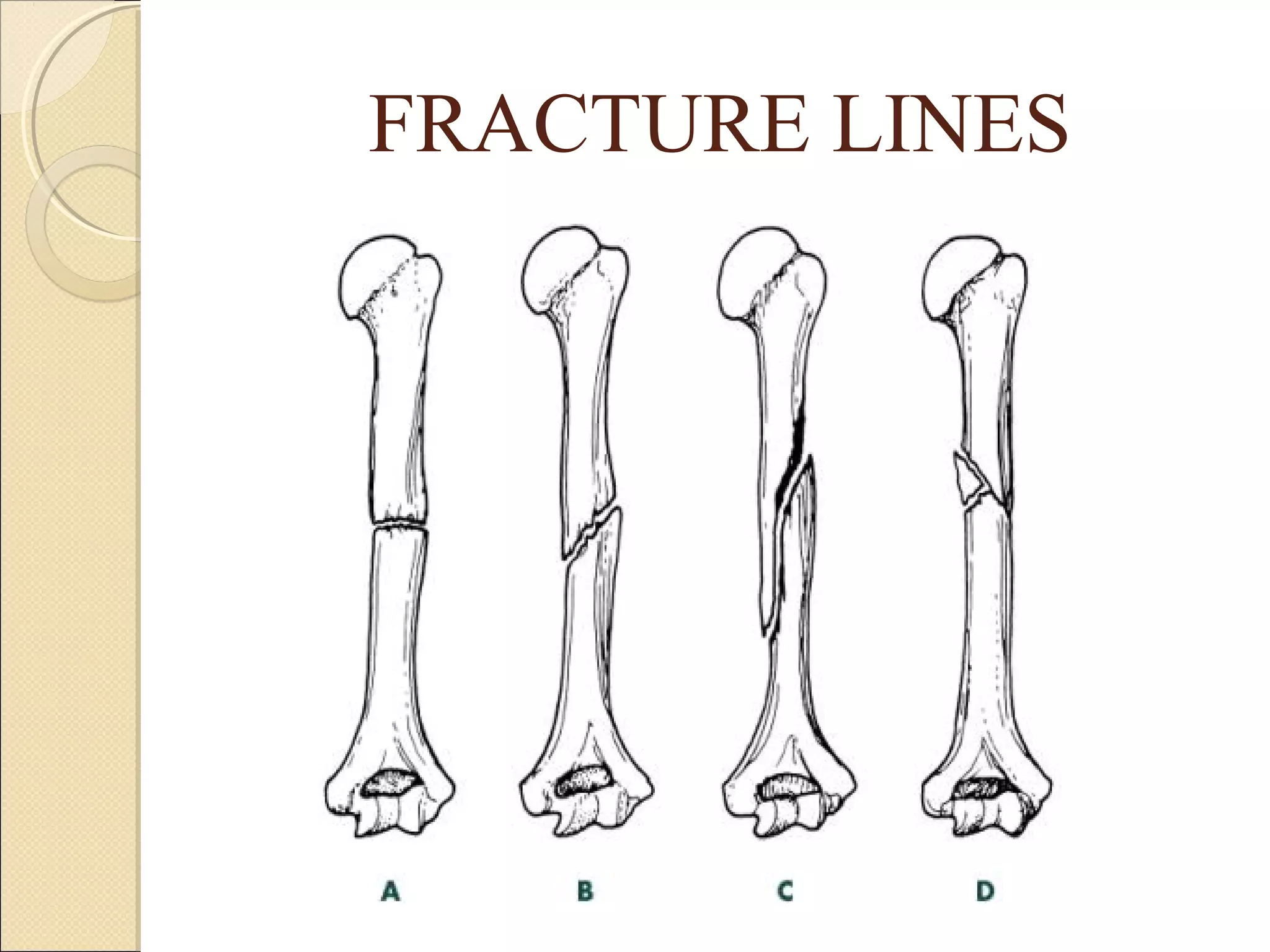 Basics of orthopedic radiology | PPT