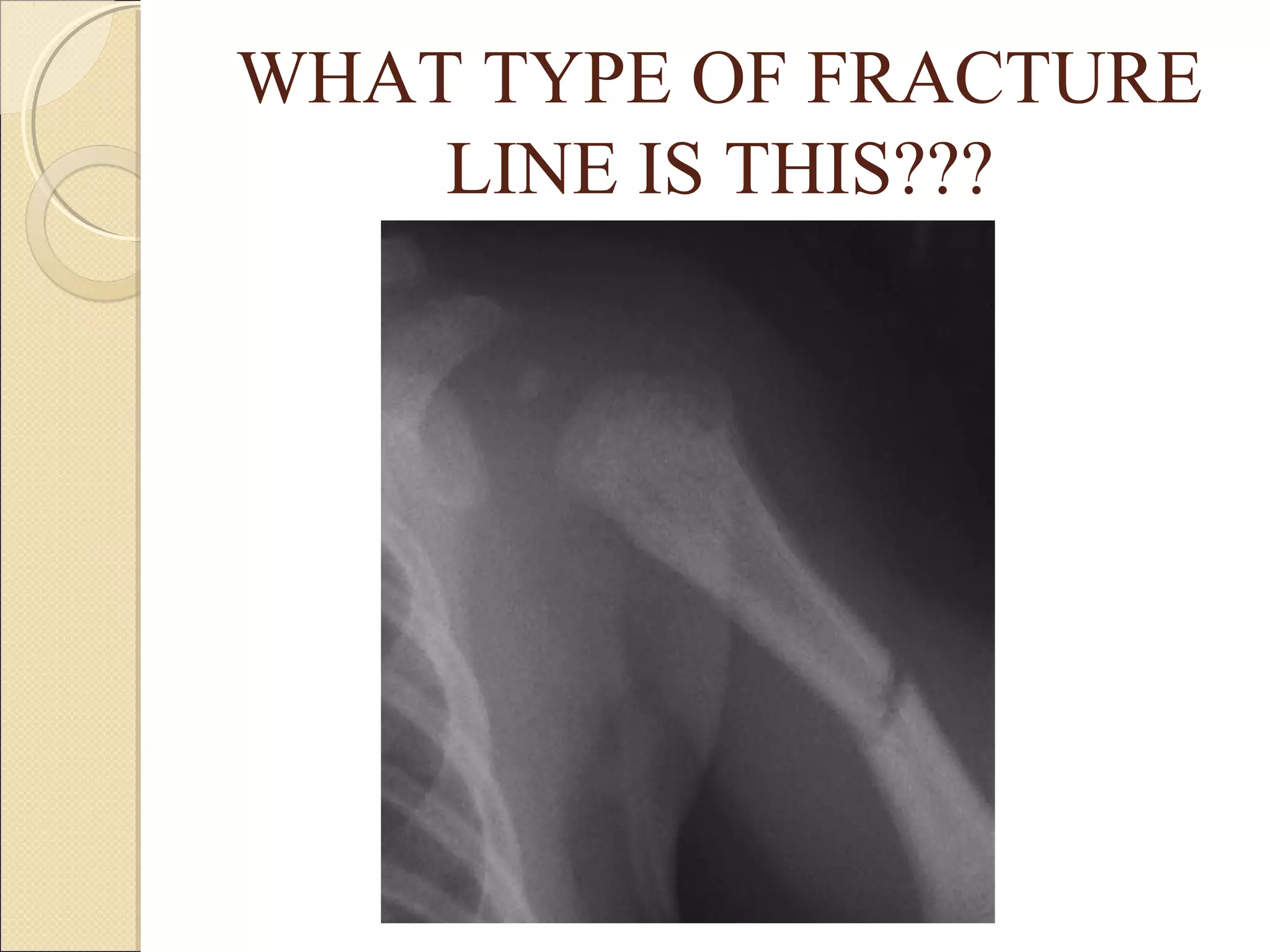 Basics of orthopedic radiology | PPT