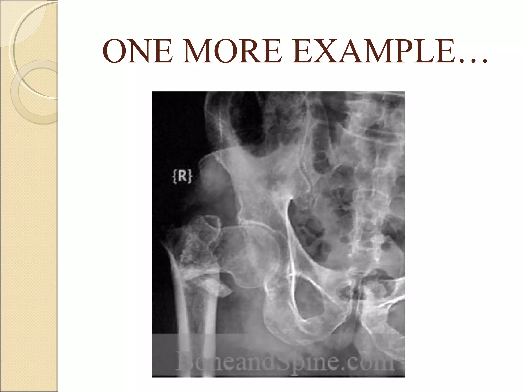 Basics of orthopedic radiology | PPT