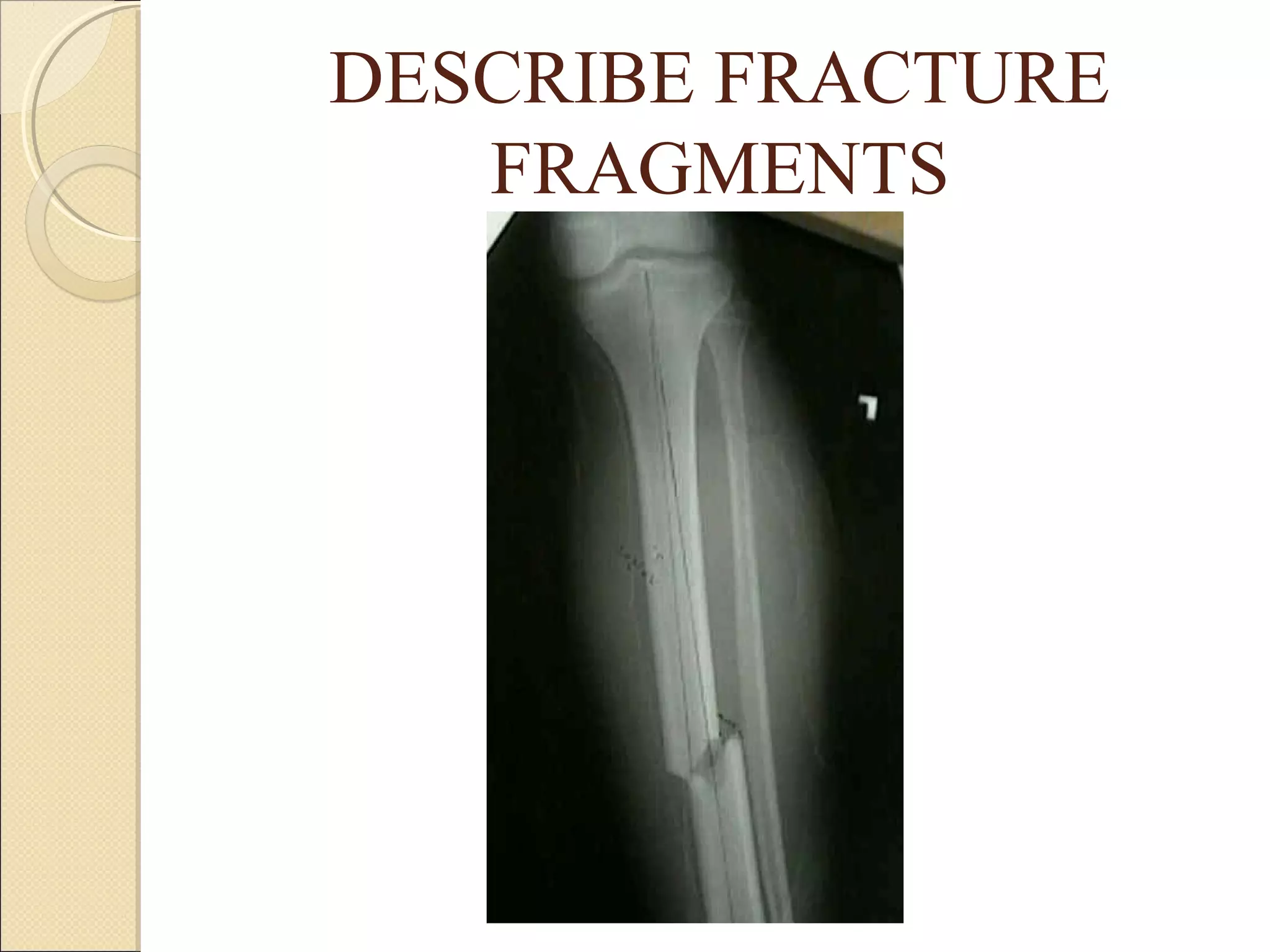 Basics of orthopedic radiology | PPT