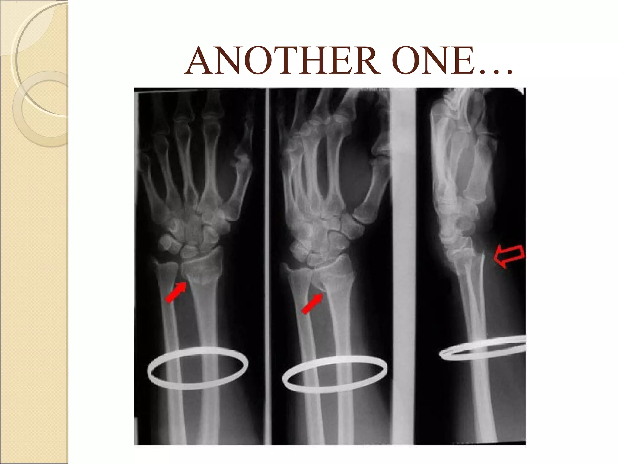 Basics of orthopedic radiology | PPT