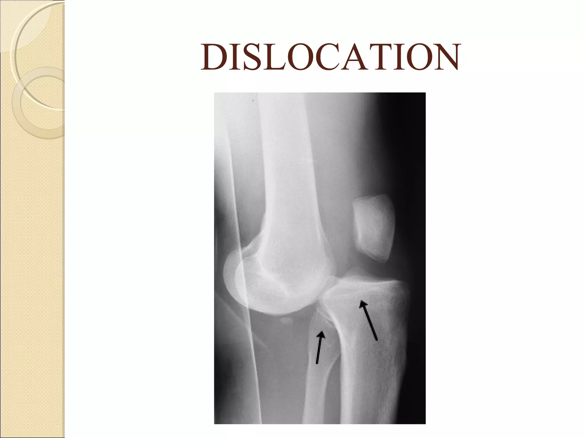Basics of orthopedic radiology | PPT
