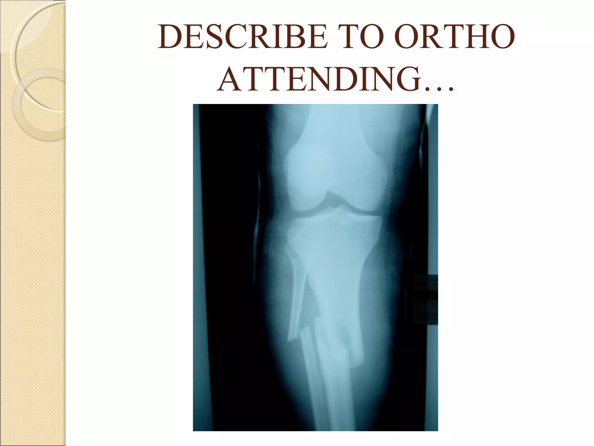 Basics of orthopedic radiology | PPT