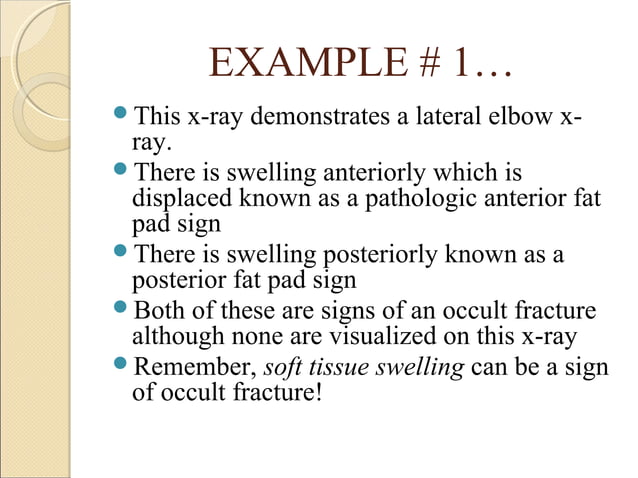 Basics of orthopedic radiology | PPT